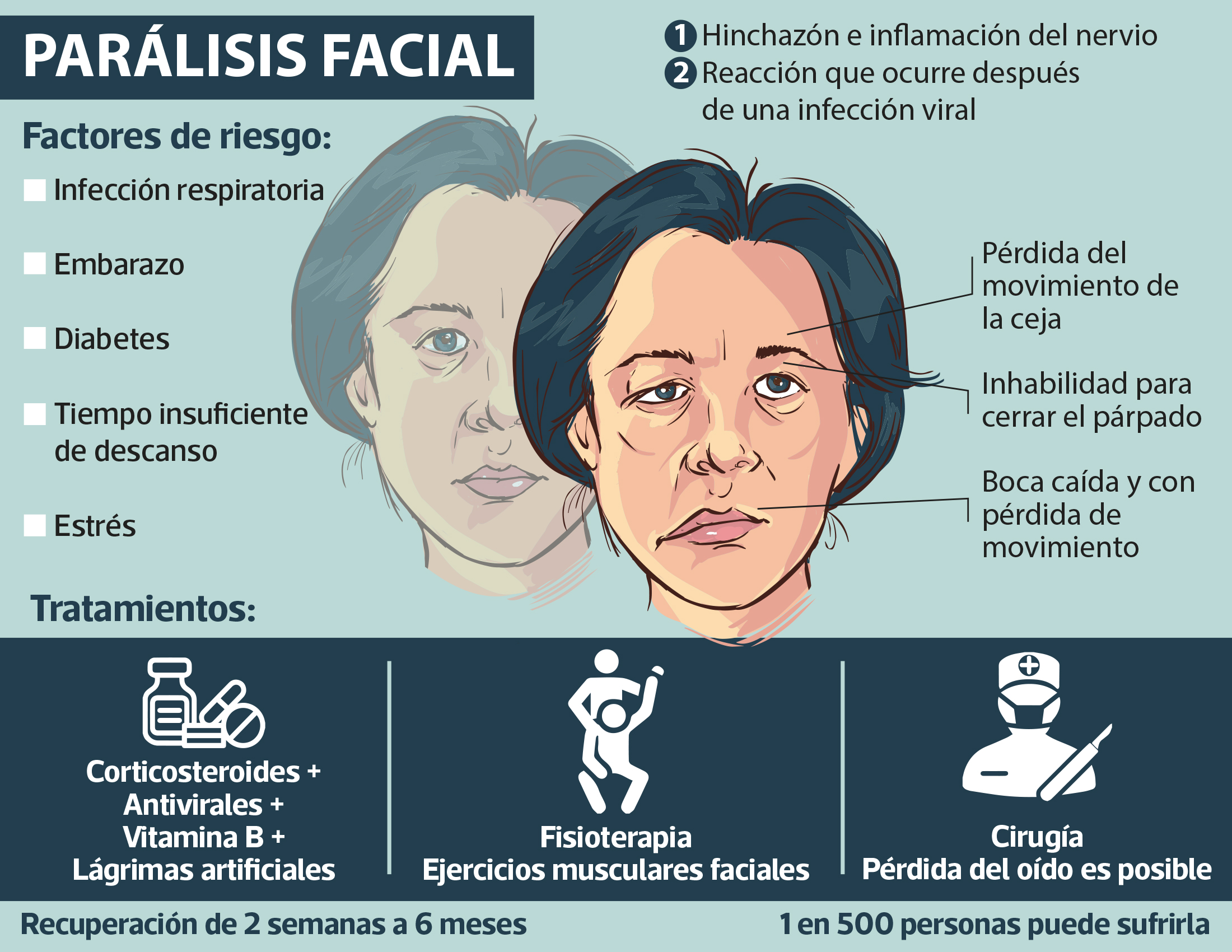 Causas y consecuencias de una parálisis facial