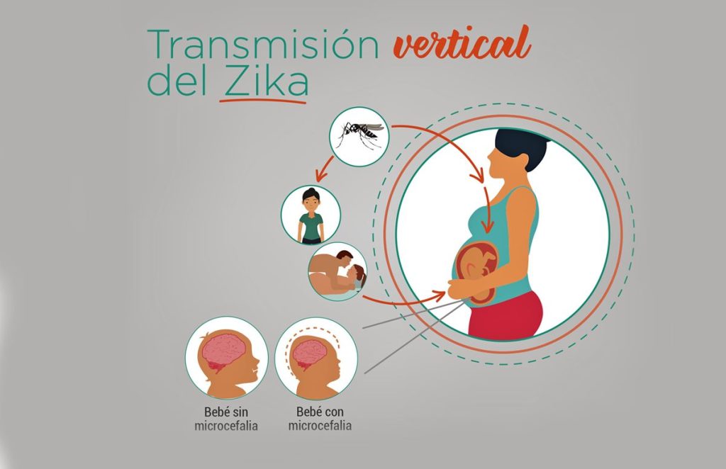 ¿Quieres proteger a tu bebé del Zika? – Prensa Libre