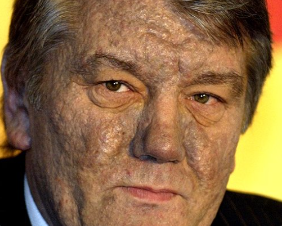 Viktor Yushchenko: la historia del presidente ucraniano que fue ...