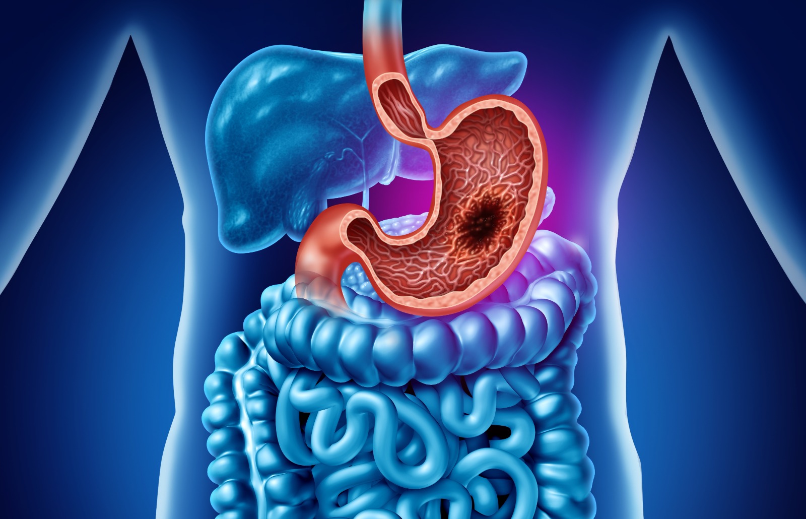 Cuáles son las enfermedades gastrointestinales: síntomas, causas y ...